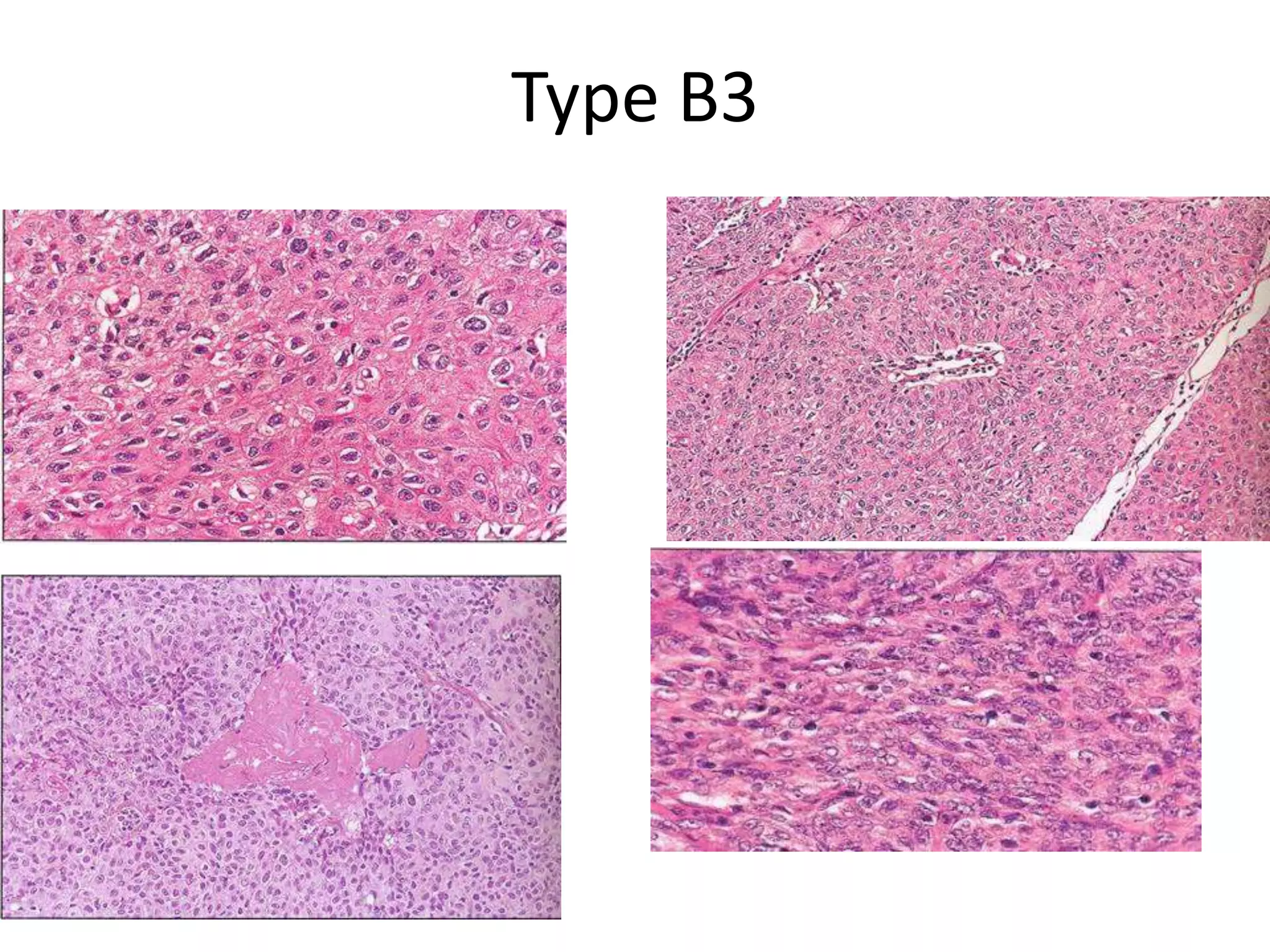 Pathology of thymus | PPTX