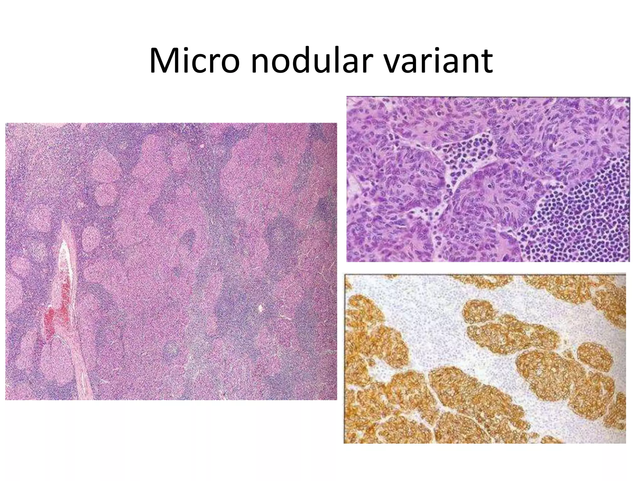 Pathology of thymus | PPTX