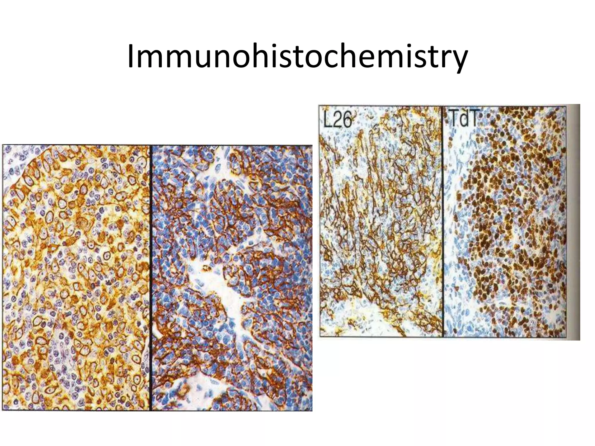 Pathology of thymus | PPTX