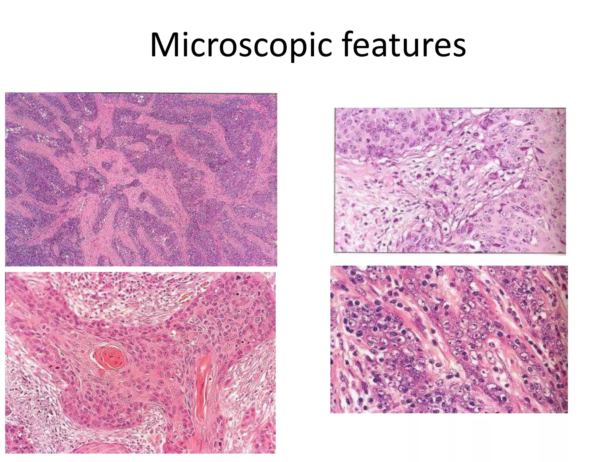 Pathology of thymus | PPTX