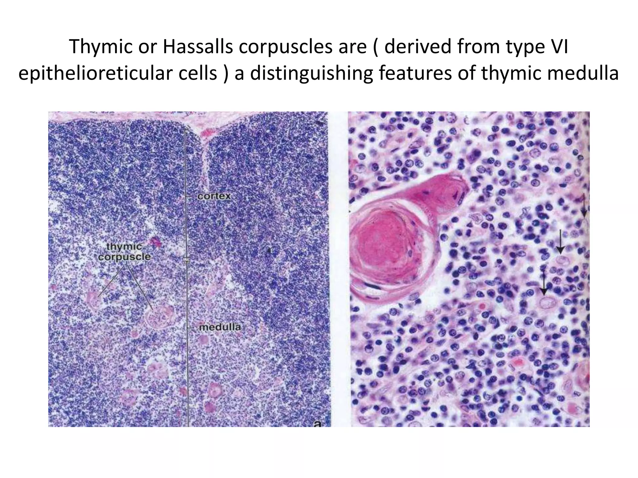Pathology of thymus | PPTX