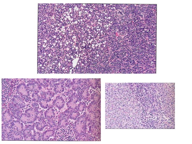 Pathology of thymus | PPTX
