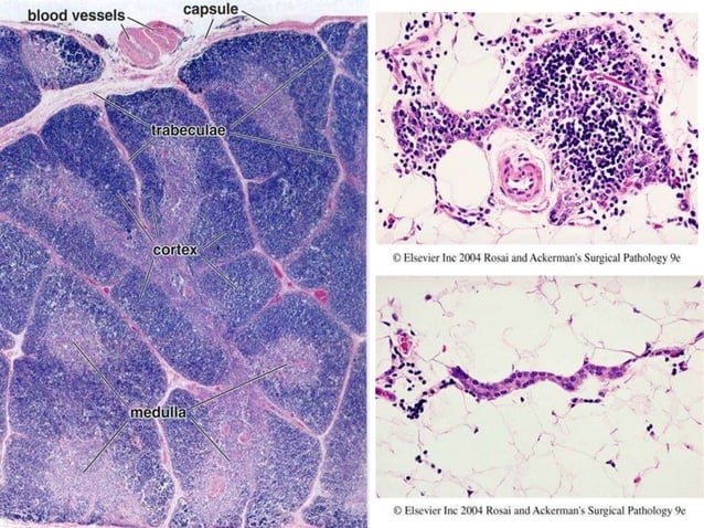 Pathology of thymus | PPTX