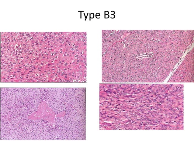 Pathology of thymus | PPTX