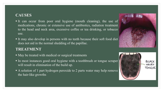 Pathology of Tonge-BASIC PATHOLOGY.pptx