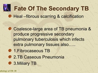 Pathology of Tuberculosis12345567778.ppt