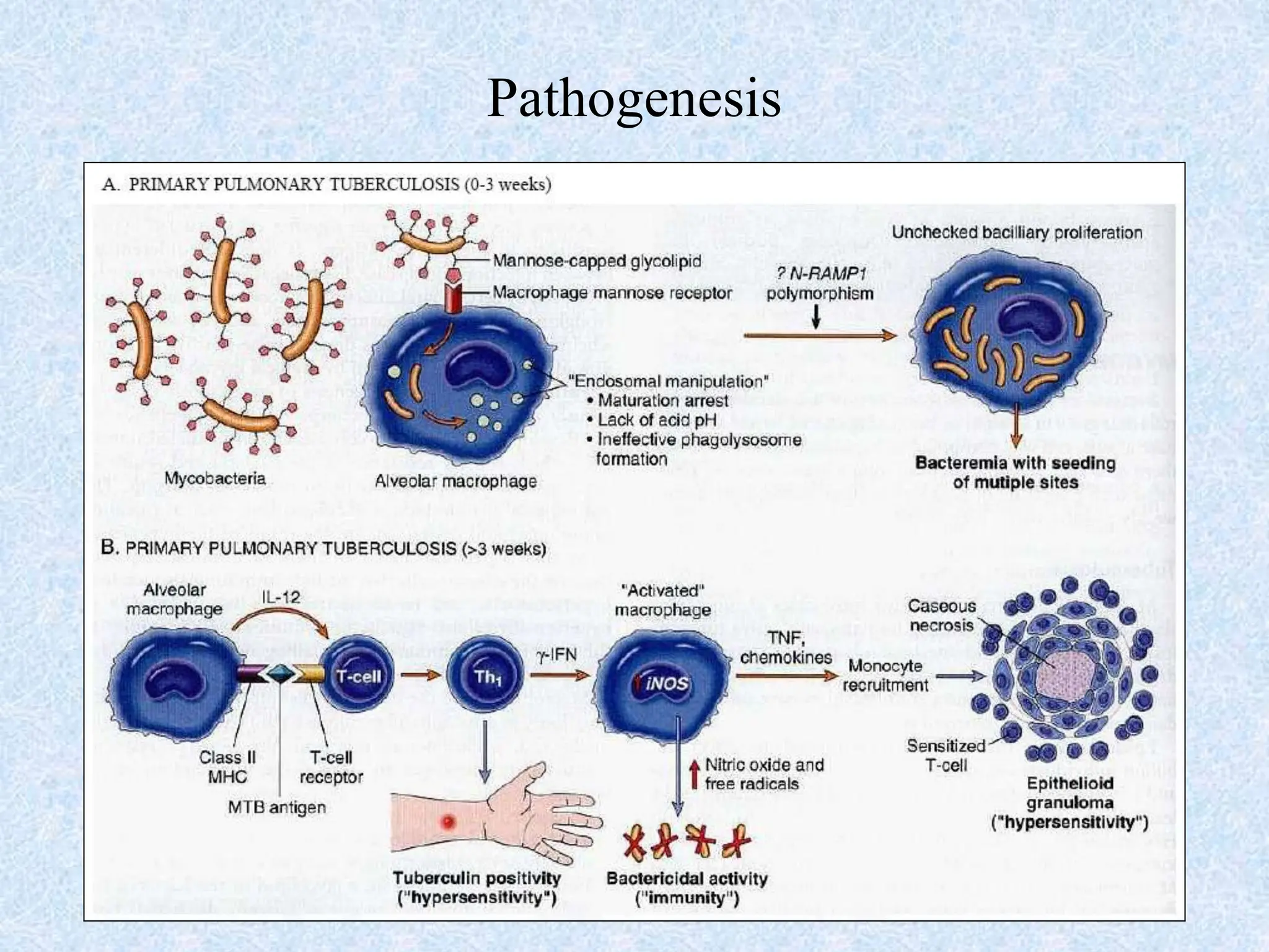Pathology of tuberculosis of lung | Jindal Chest Clinic | PPT ...