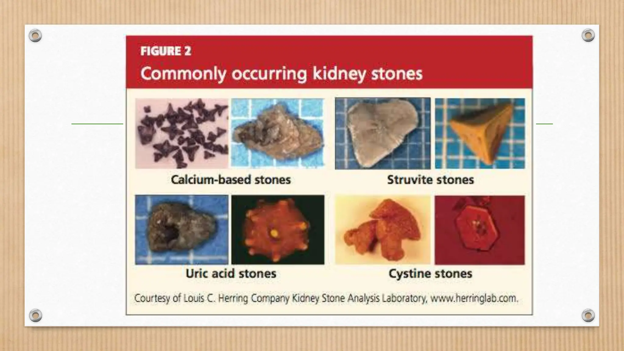 PATHOLOGY OF URINARY SYSTEM DISORDER ppt | PPTX