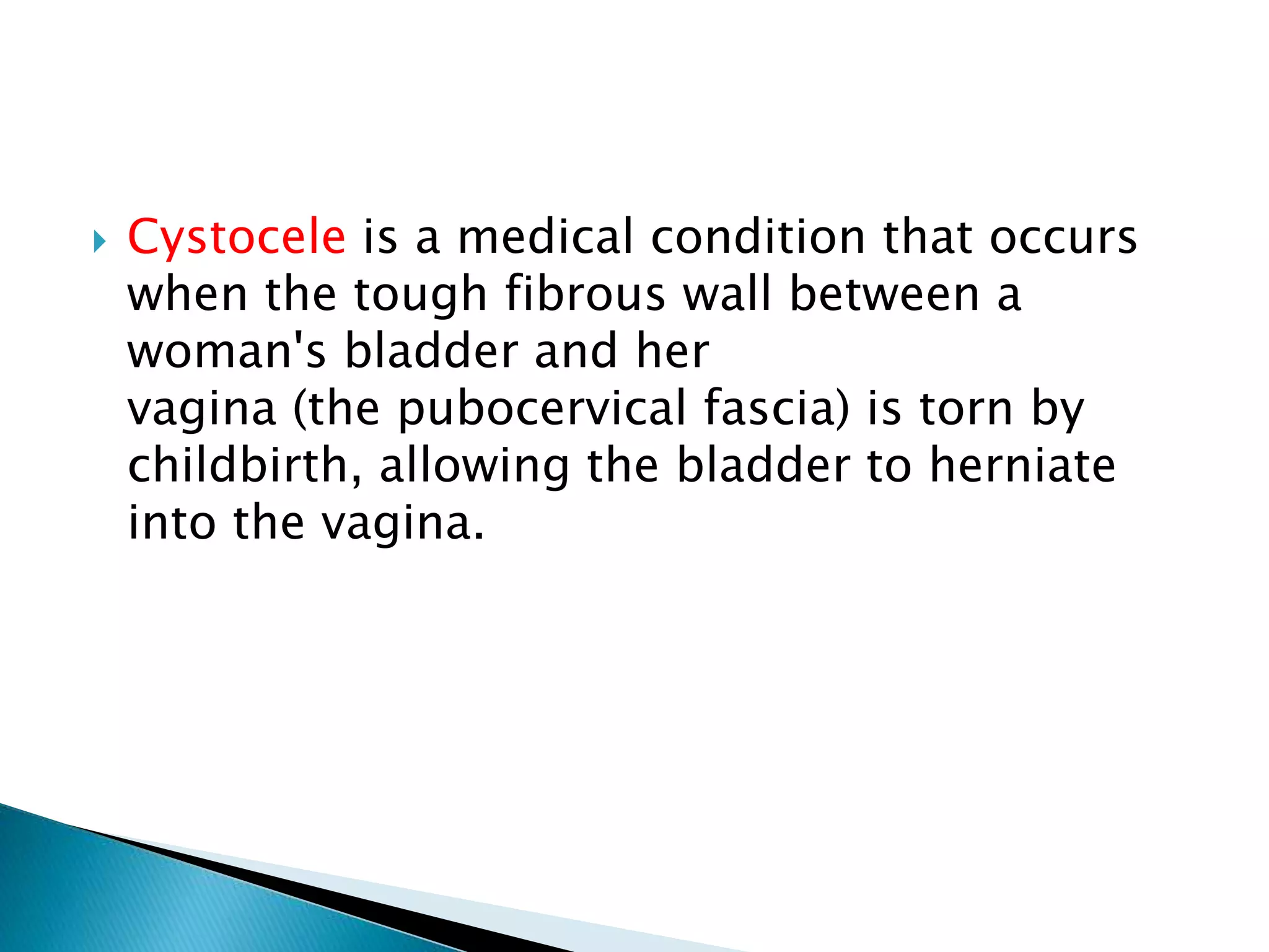 Pathology of urinary system | PPT