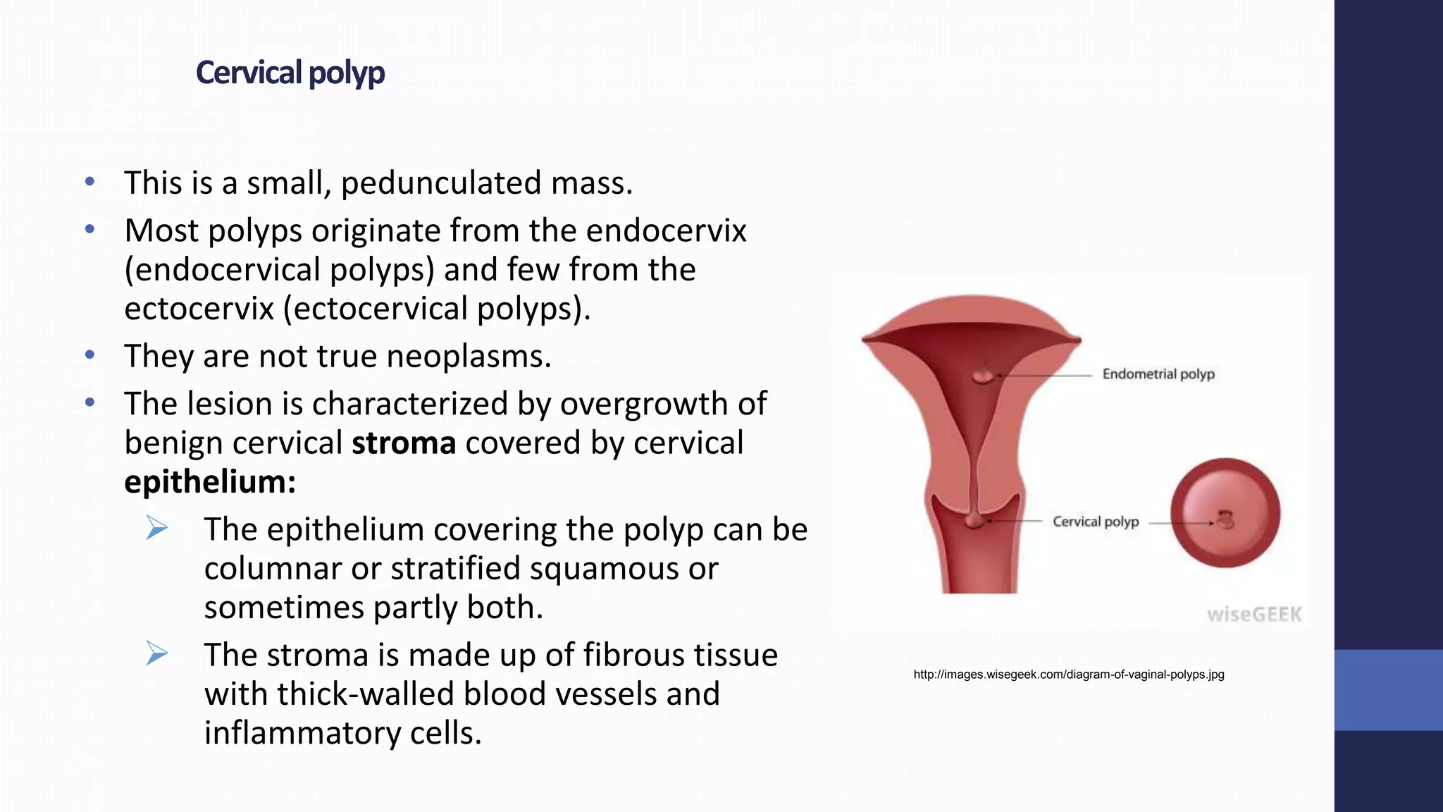 Pathology of uterine cervix 2018 Sufia Husain | PPTX