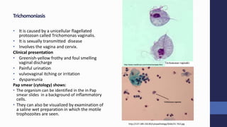Pathology of uterine cervix 2018 Sufia Husain | PPTX