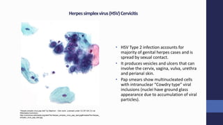 Pathology of uterine cervix 2018 Sufia Husain | PPTX