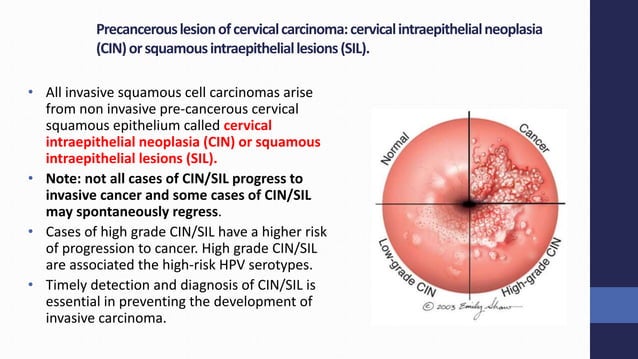 Pathology of uterine cervix 2018 Sufia Husain