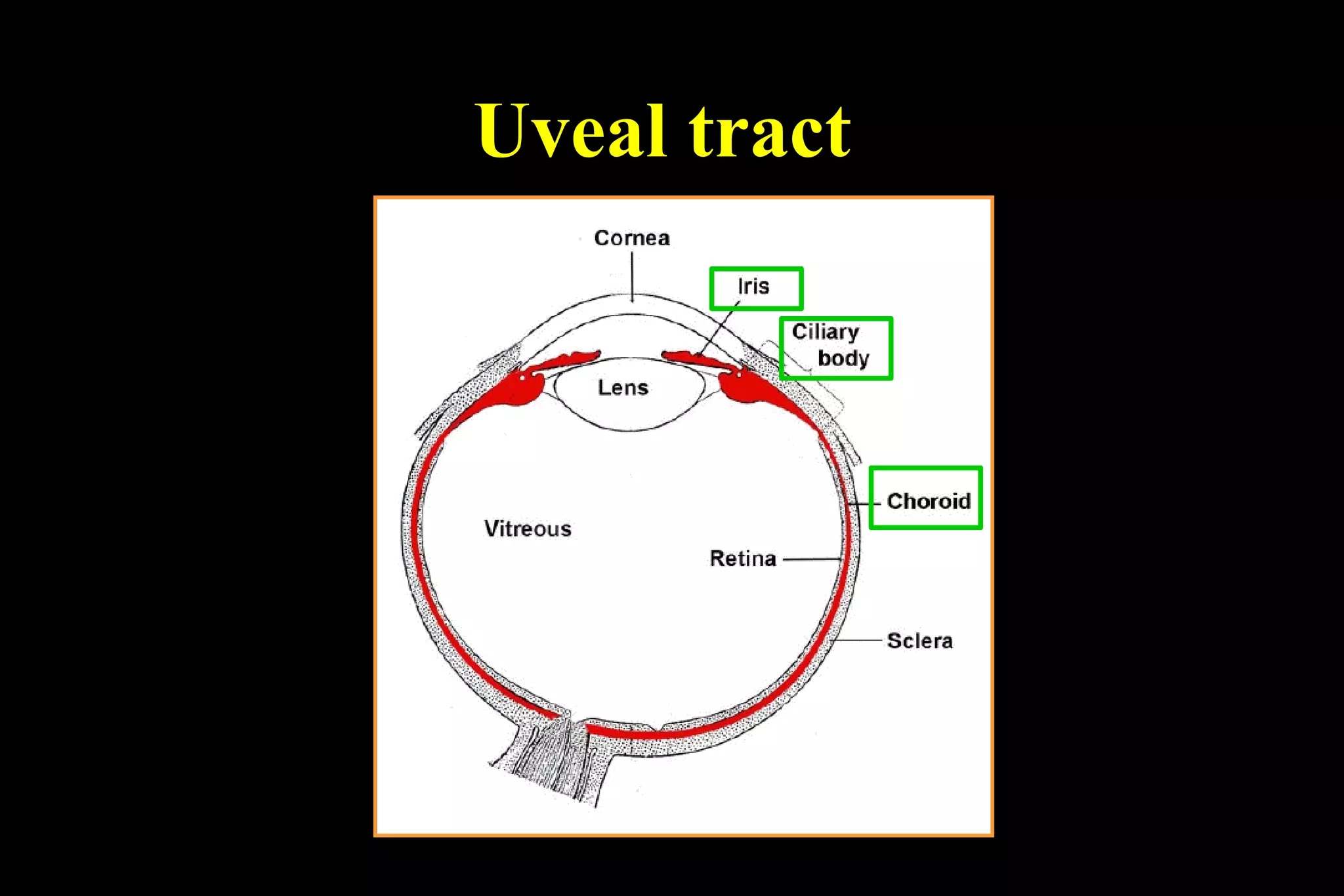 Pathology of uvea | PPT
