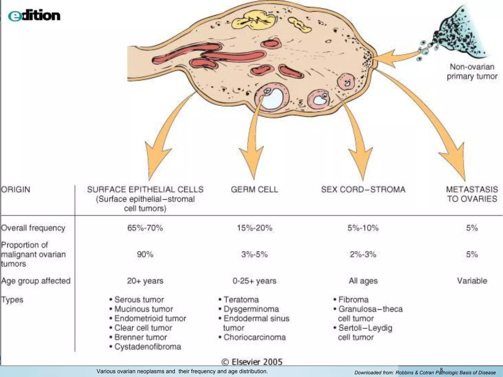 Pathology, Ovarian Cyst and Tumors Dr. Sufia Husain 2018 | PPTX
