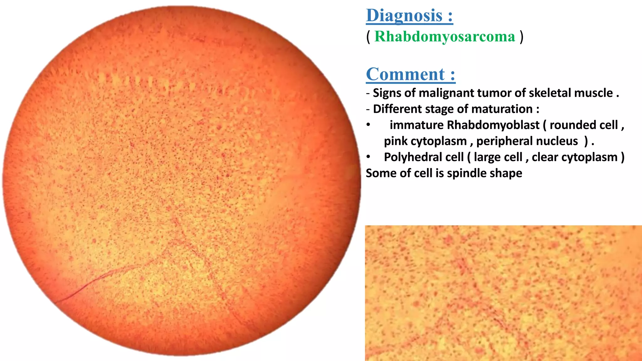 Pathology (pathology of joint and soft tissue disorders) | PDF
