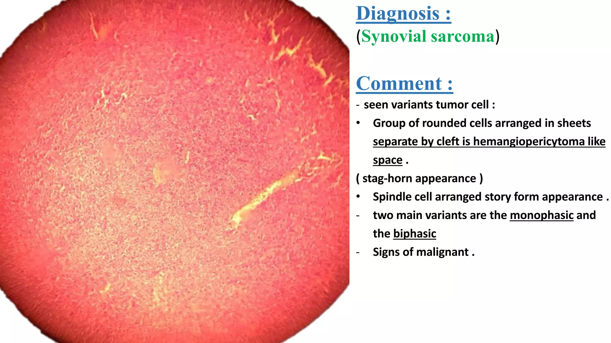 Pathology (pathology of joint and soft tissue disorders) | PDF
