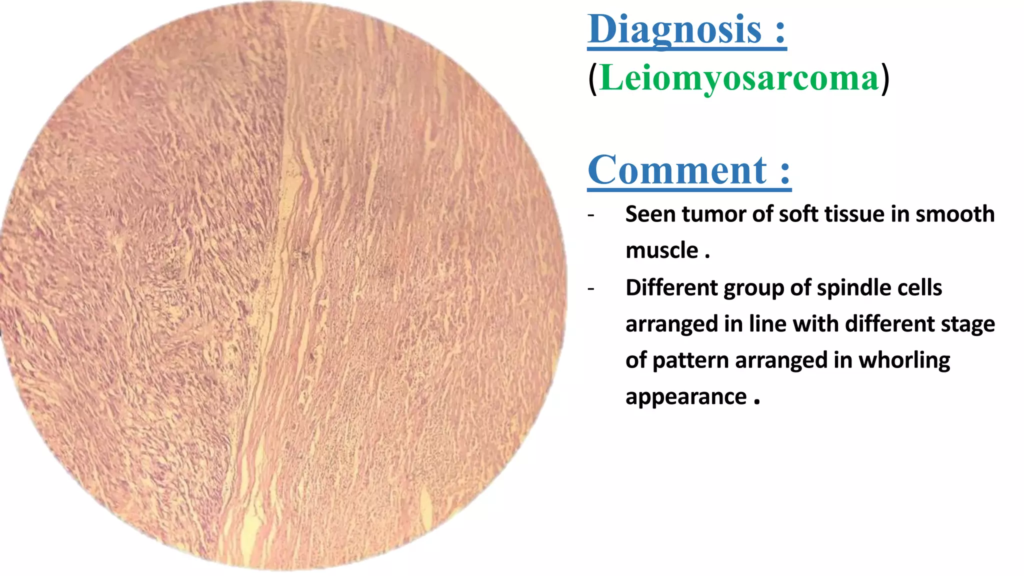 Pathology (pathology of joint and soft tissue disorders) | PDF