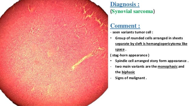 Pathology (pathology of joint and soft tissue disorders)
