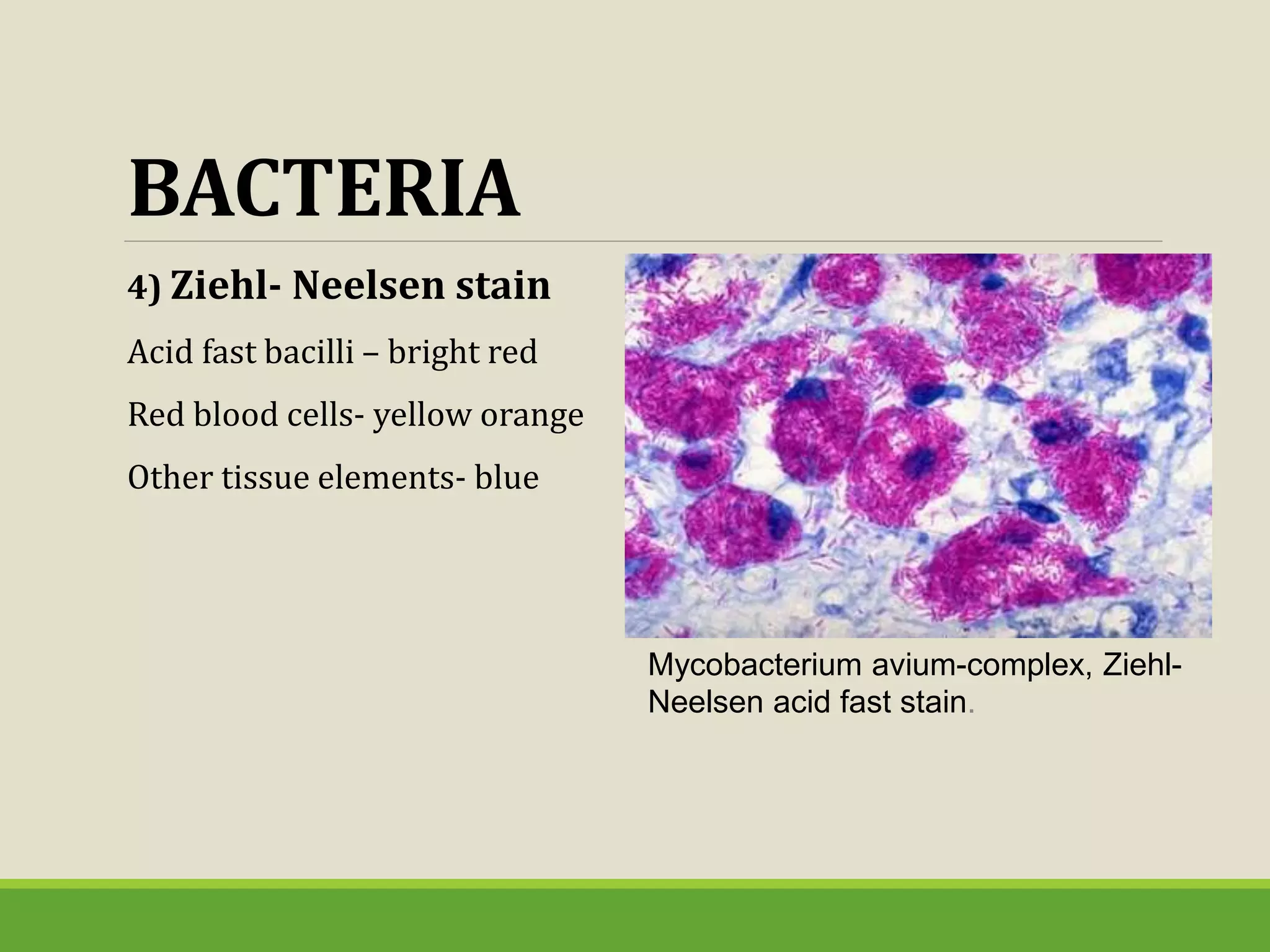 Special staining techniques for microorganisms | PPTX
