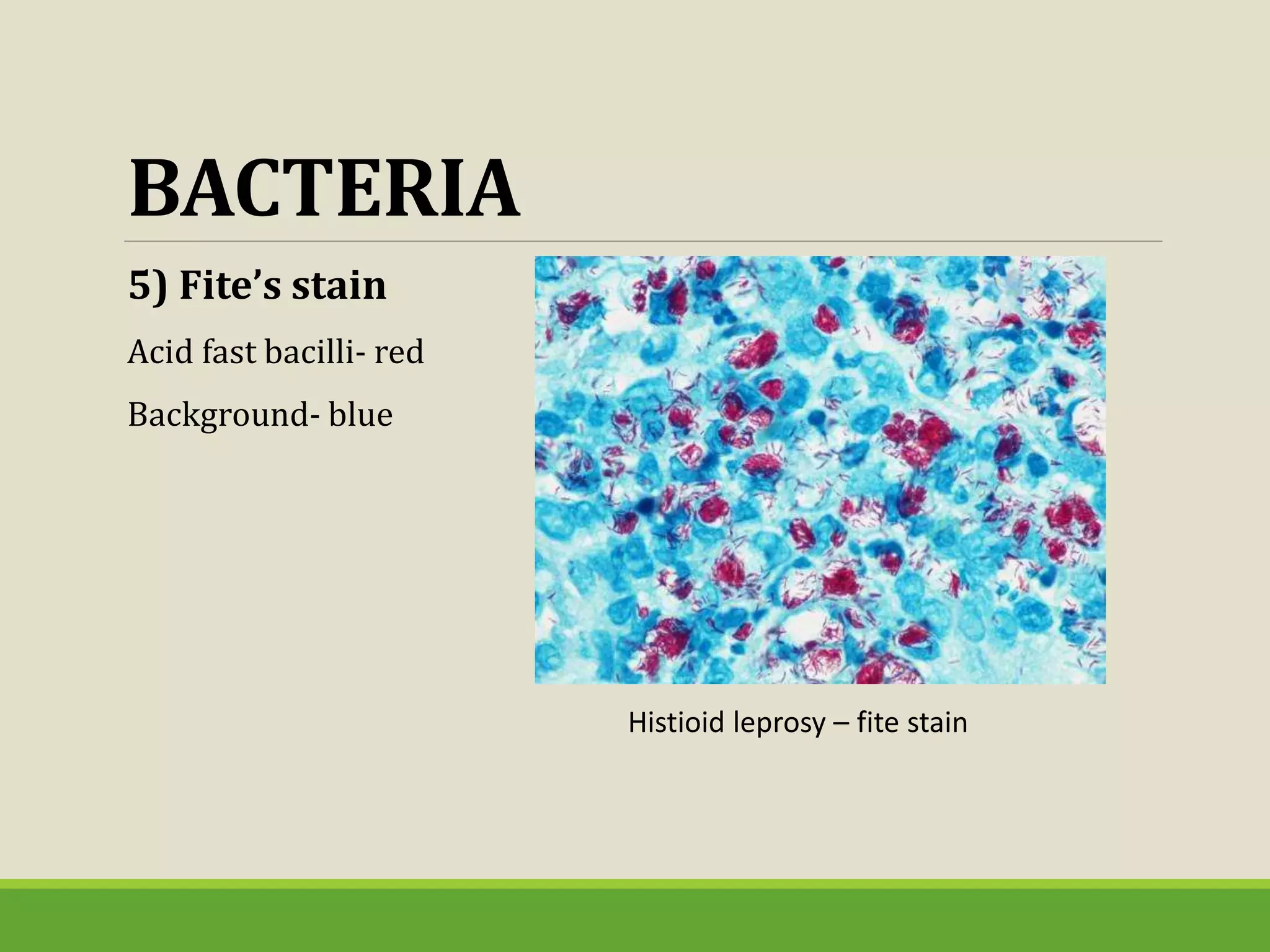 Special staining techniques for microorganisms | PPTX