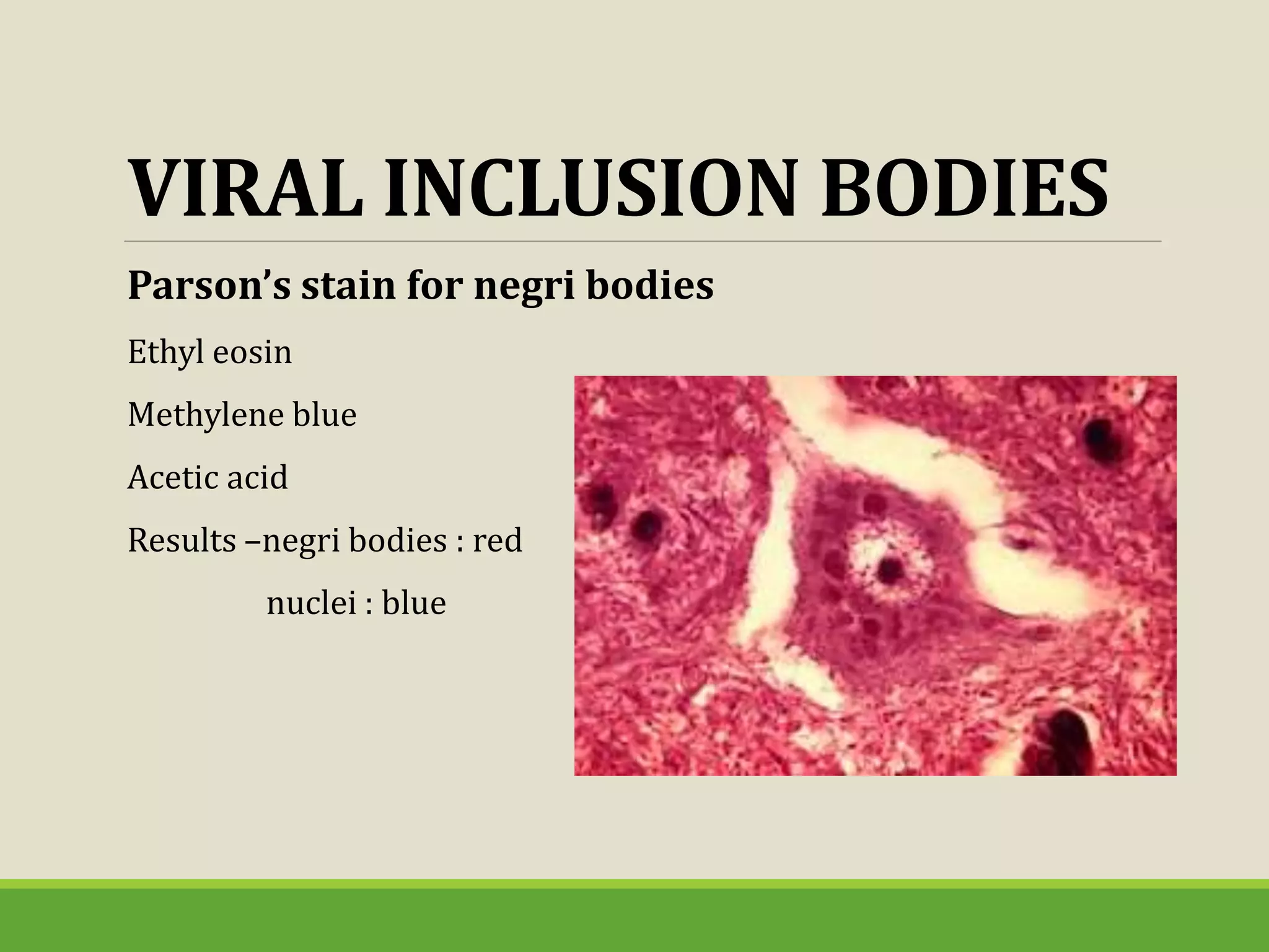 Special staining techniques for microorganisms | PPTX