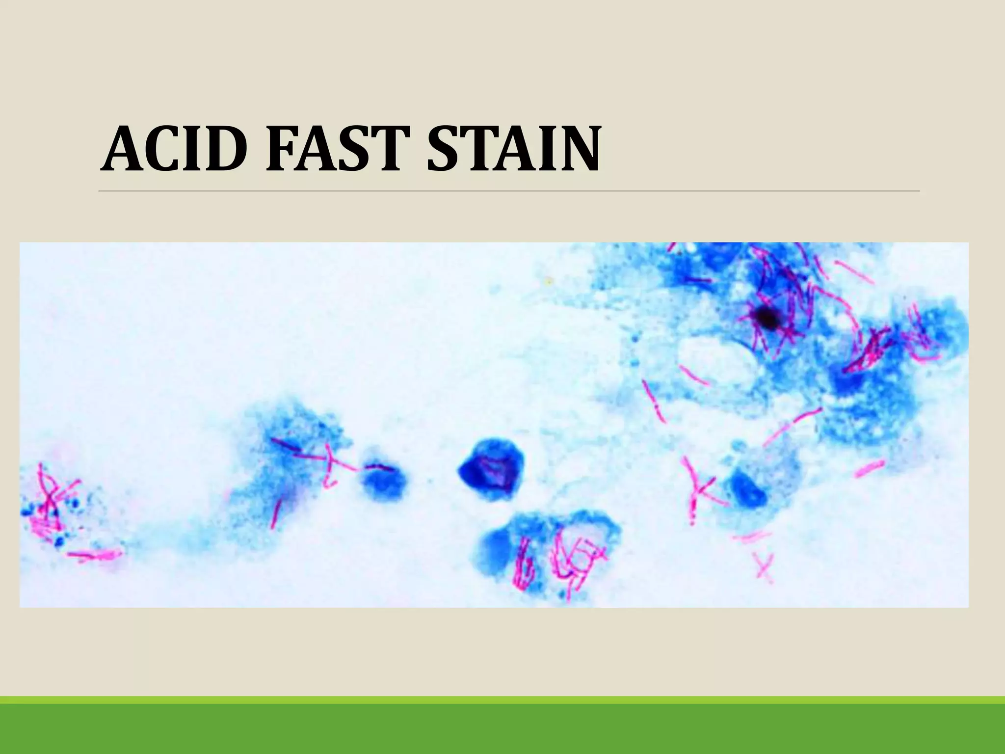 Special staining techniques for microorganisms | PPTX