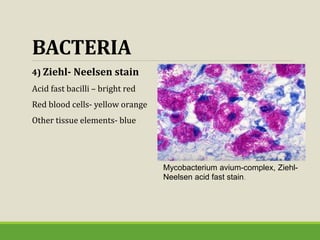 Special staining techniques for microorganisms | PPTX
