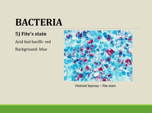 Special staining techniques for microorganisms | PPTX | Chemistry | Science