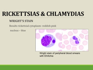 Special staining techniques for microorganisms | PPTX