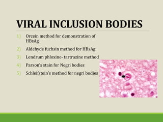 Special staining techniques for microorganisms | PPTX