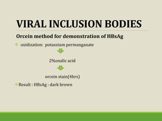 Special staining techniques for microorganisms | PPTX