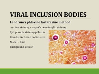 Special staining techniques for microorganisms | PPTX