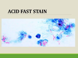 Special staining techniques for microorganisms | PPTX