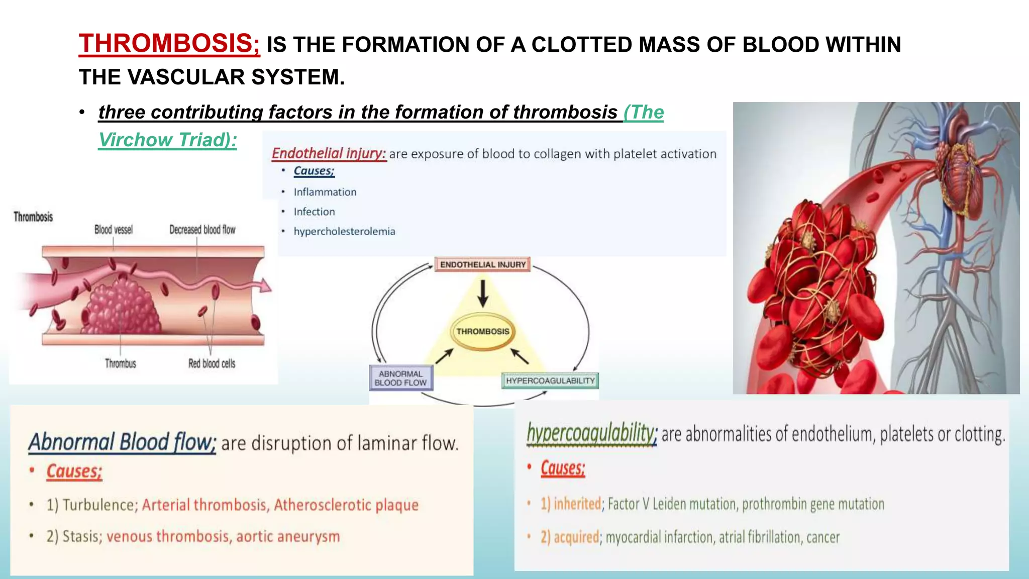Thrombosis, Embolism, Infarction, Coagulation & Shock . pptx | PPTX