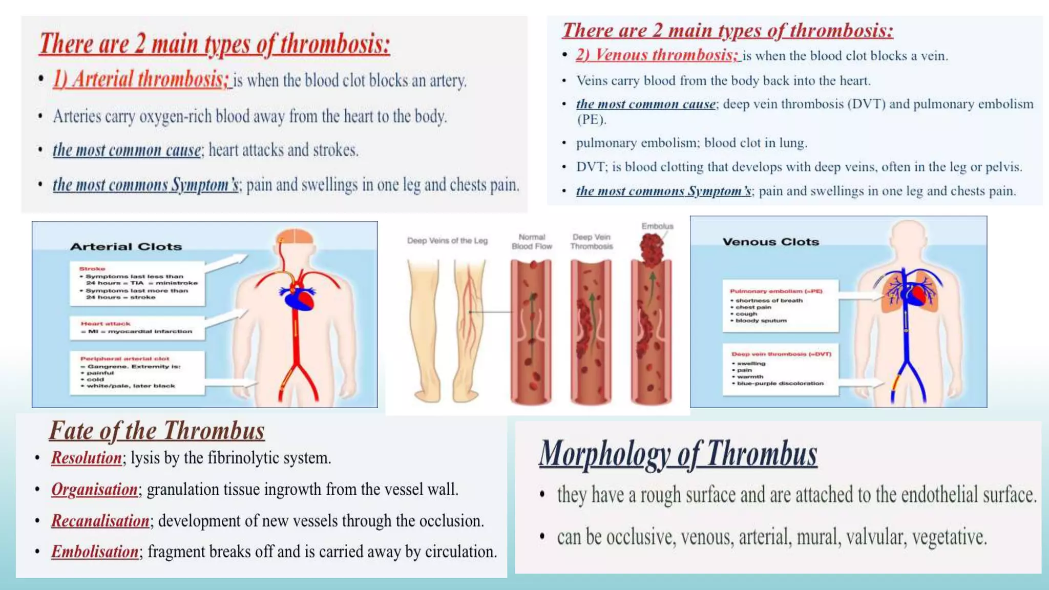 Thrombosis, Embolism, Infarction, Coagulation & Shock . pptx | PPTX