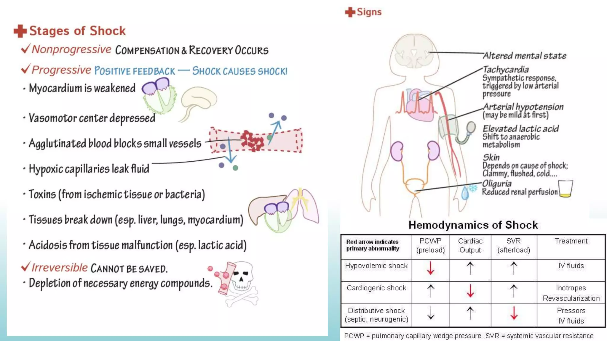 Thrombosis, Embolism, Infarction, Coagulation & Shock . pptx | PPTX
