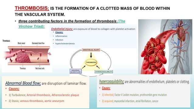 Thrombosis, Embolism, Infarction, Coagulation & Shock . pptx | PPT