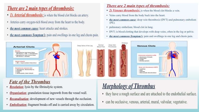 Thrombosis, Embolism, Infarction, Coagulation & Shock . pptx | PPT