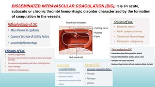 Thrombosis, Embolism, Infarction, Coagulation & Shock . pptx | PPTX
