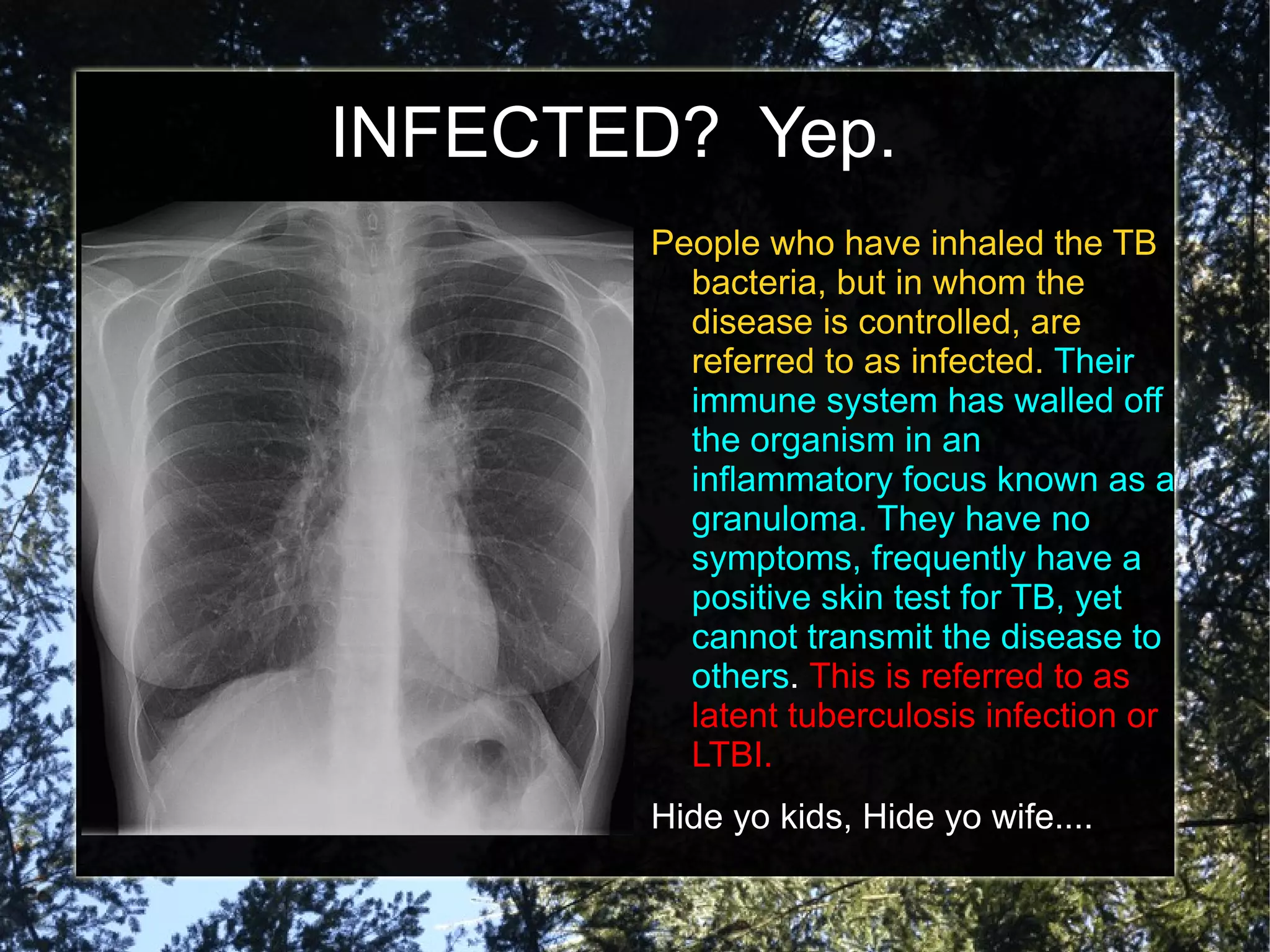 Pathology project powerpoint tb | PPT