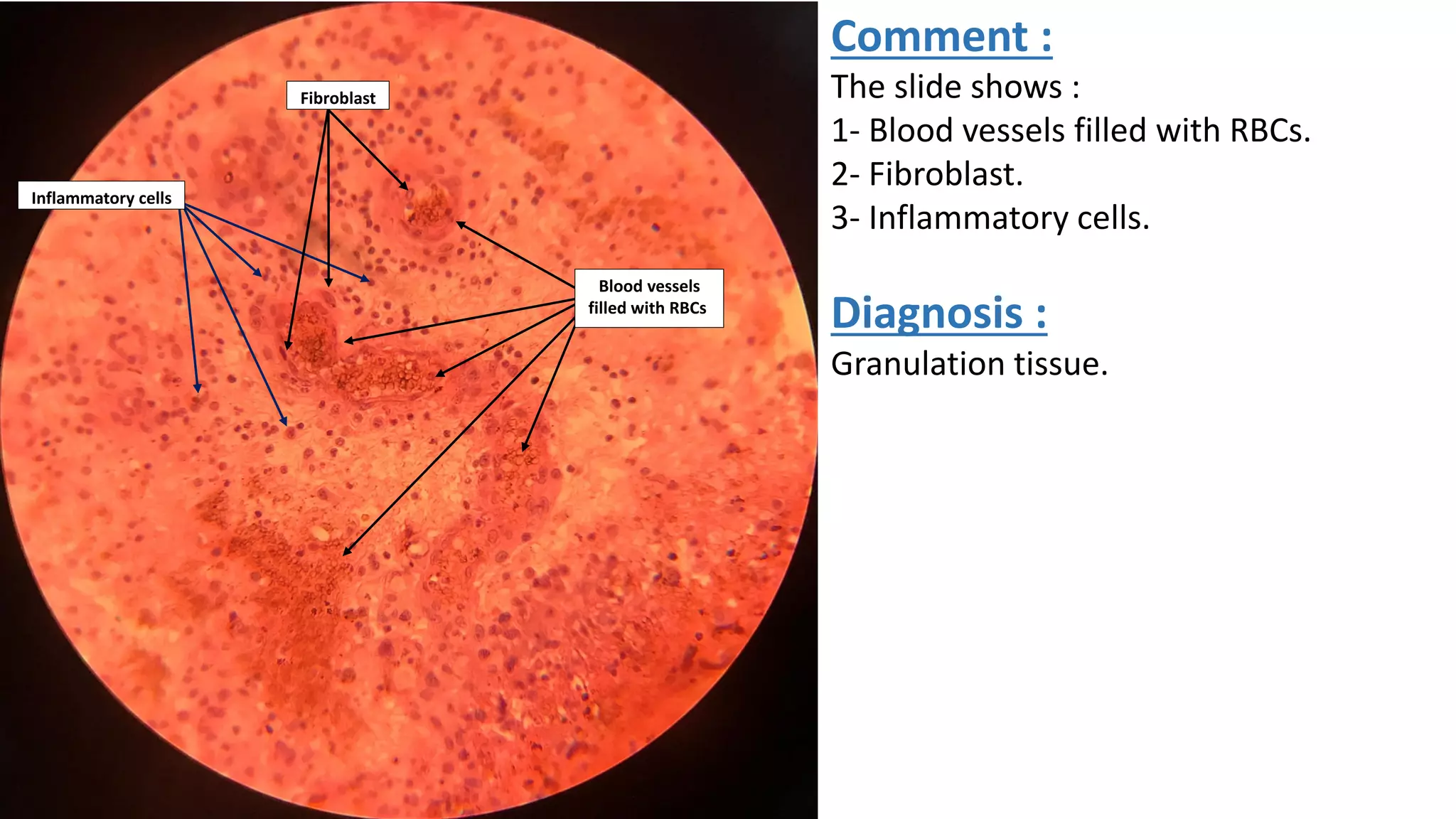 Pathology (repair and wound healing) | PDF