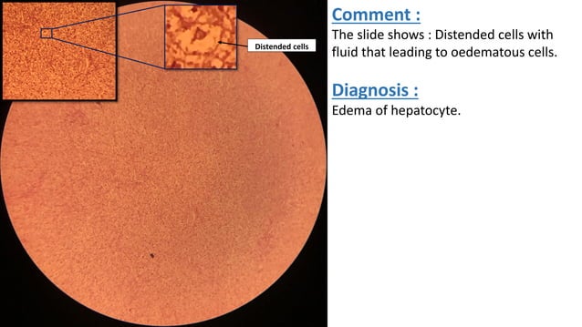 Pathology (repair and wound healing) | PDF