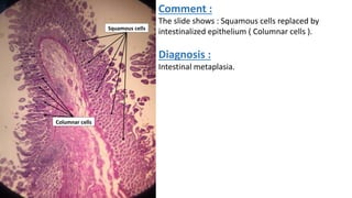 Pathology (repair and wound healing) | PDF