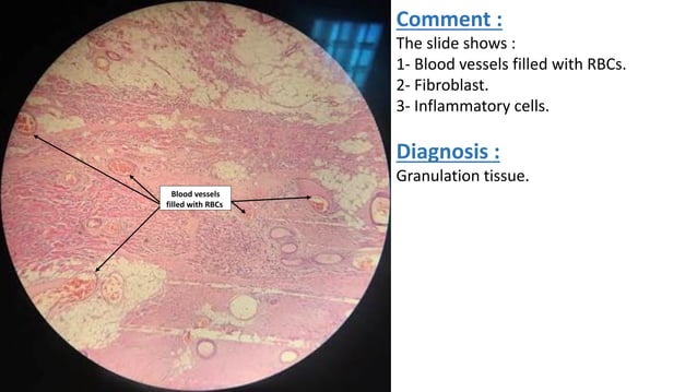 Pathology (repair and wound healing) | PDF