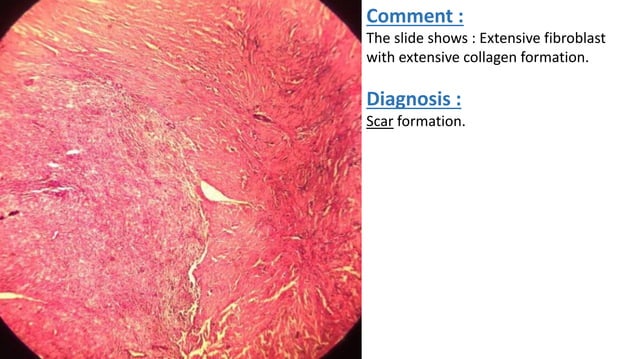 Pathology (repair and wound healing) | PDF