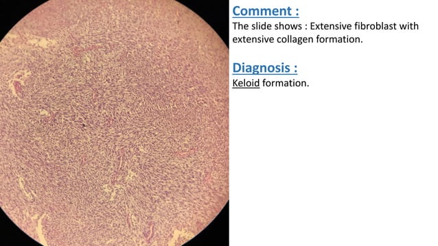 Pathology (repair and wound healing) | PDF