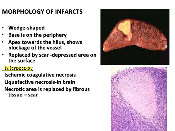 Pathology+slides