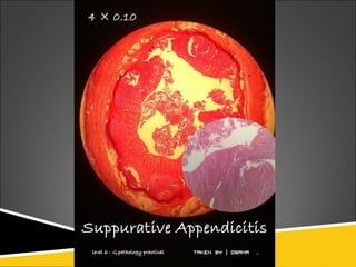 Pathology slides | PPT