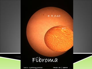 Pathology slides | PPT